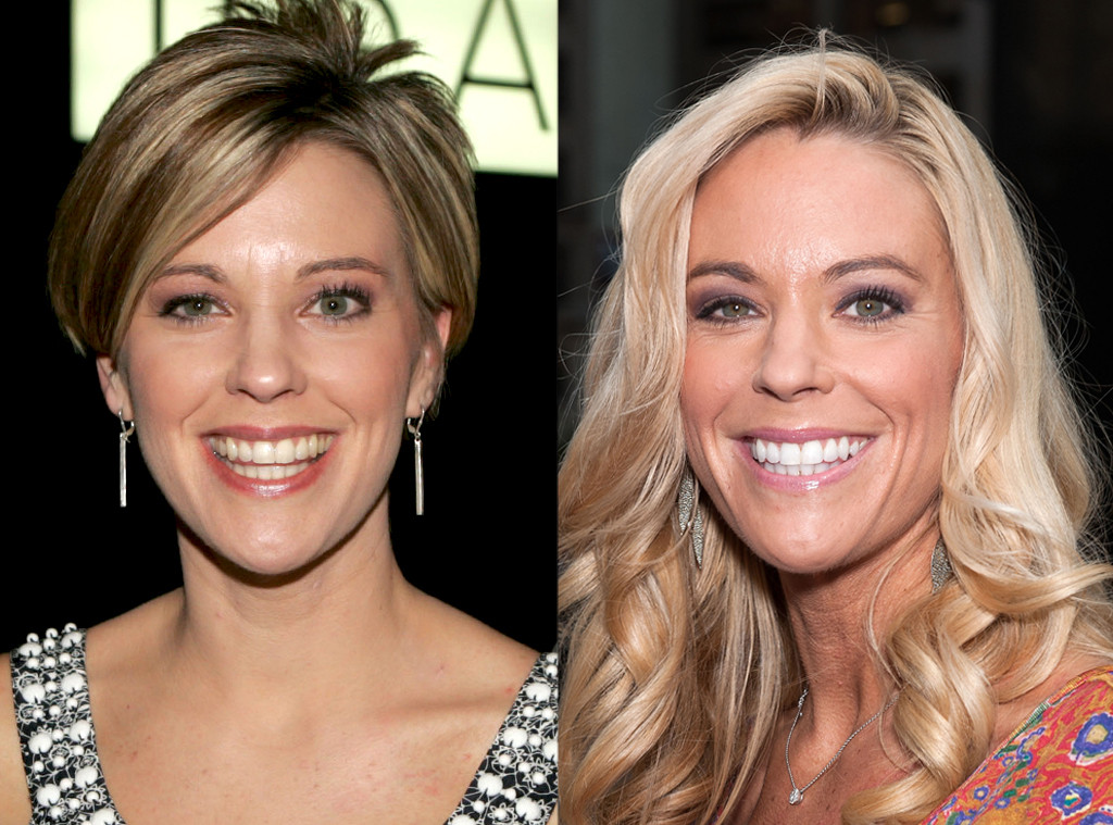 "Kate Plus 8" Cast Kate Gosselin Plastic Surgey Before & After